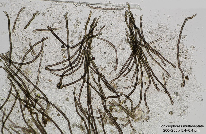 Cladosporium Herbarum The Genus Cladosporium. Document Gale