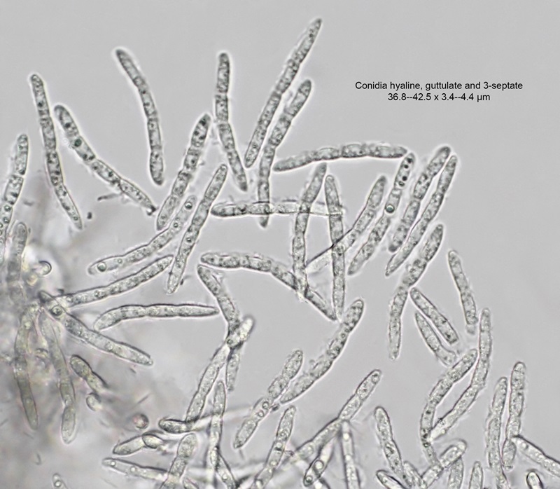 Mycosphaerella - Alchetron, The Free Social Encyclopedia