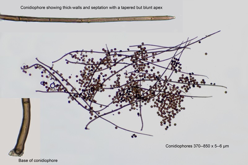 Periconia byssoides Fungus Species
